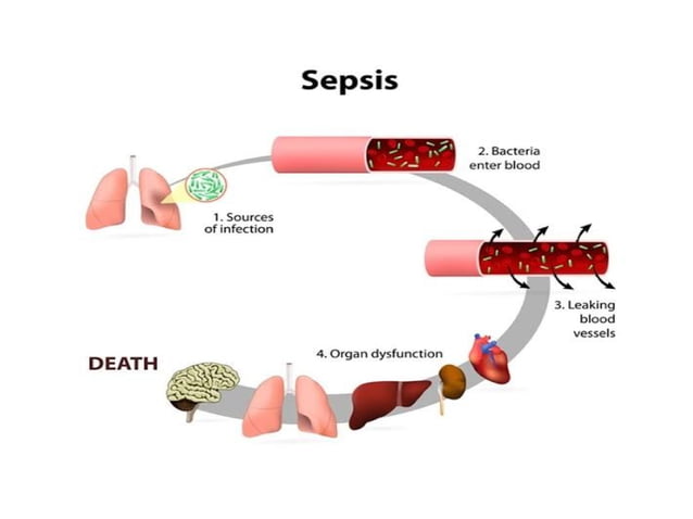 Blood and lymph (Septicemia).pptx Practical 1.pptx