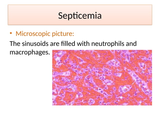 Blood and lymph (Septicemia).pptx Practical 1.pptx
