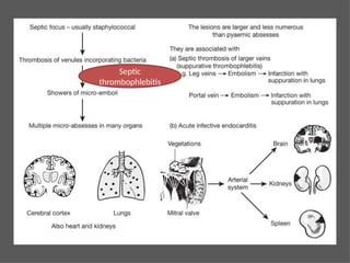 Blood and lymph (Septicemia).pptx Practical 1.pptx