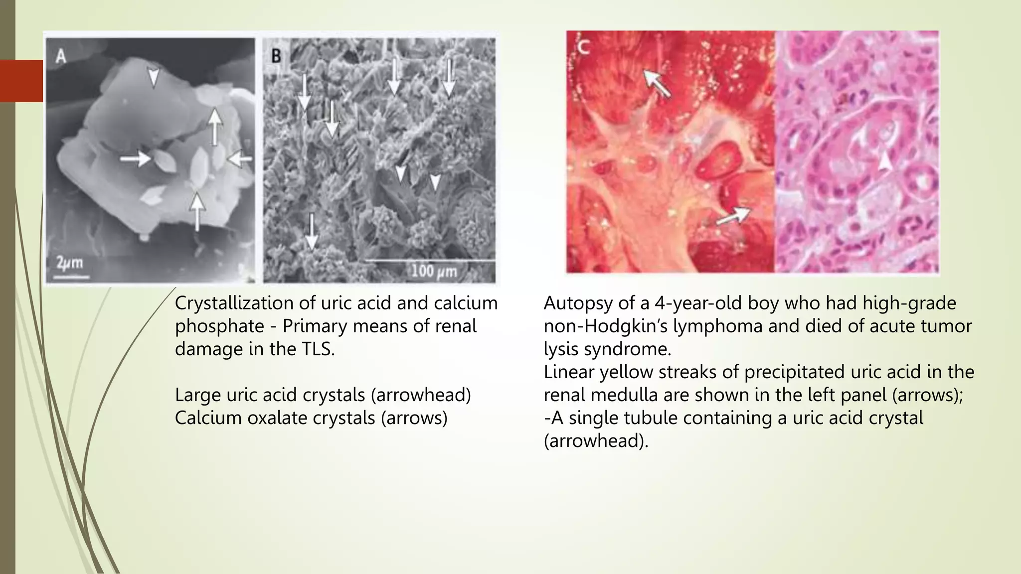 Blood Basics TLS.pptx