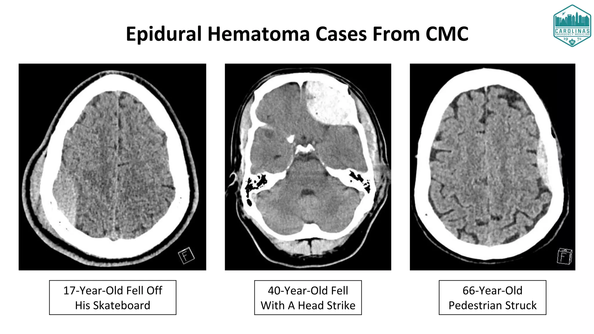Blood Can Be Very Very Bad - CMC Neuroimaging Case Studies | PPTX