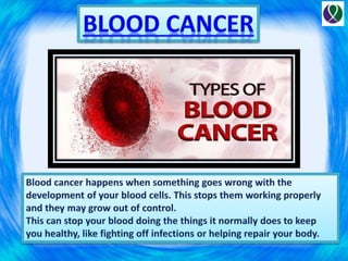 New techniques for fighting against blood cancer by The cure for ...