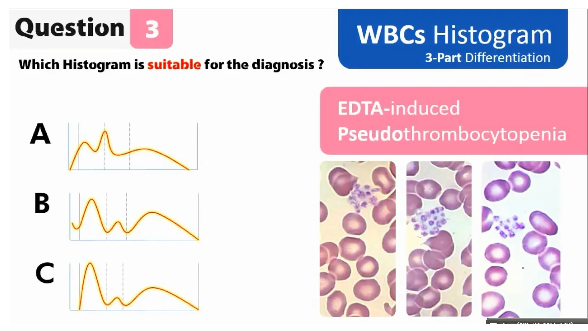 Blood Cell Histograms modified hematology.pptx