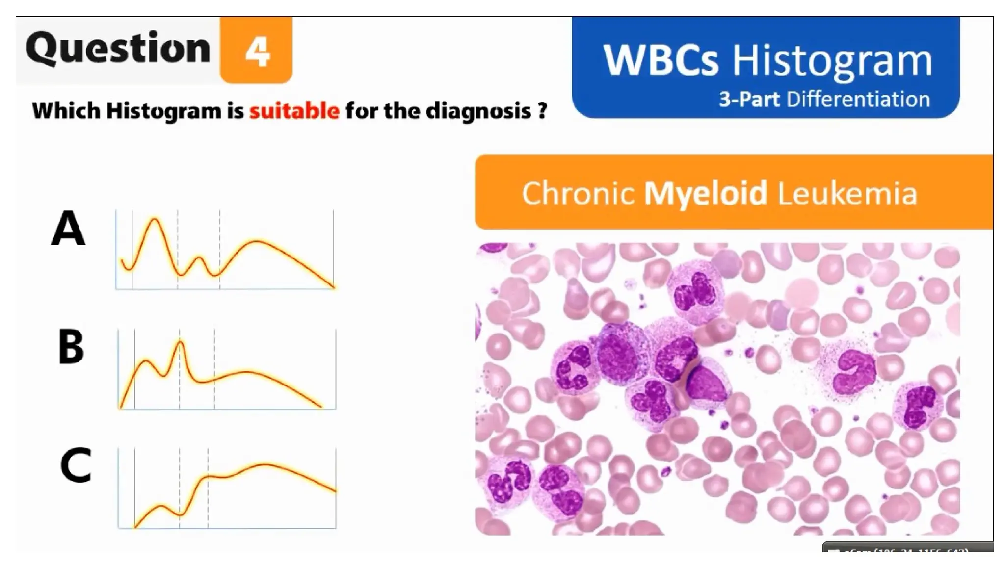 Blood Cell Histograms modified hematology.pptx
