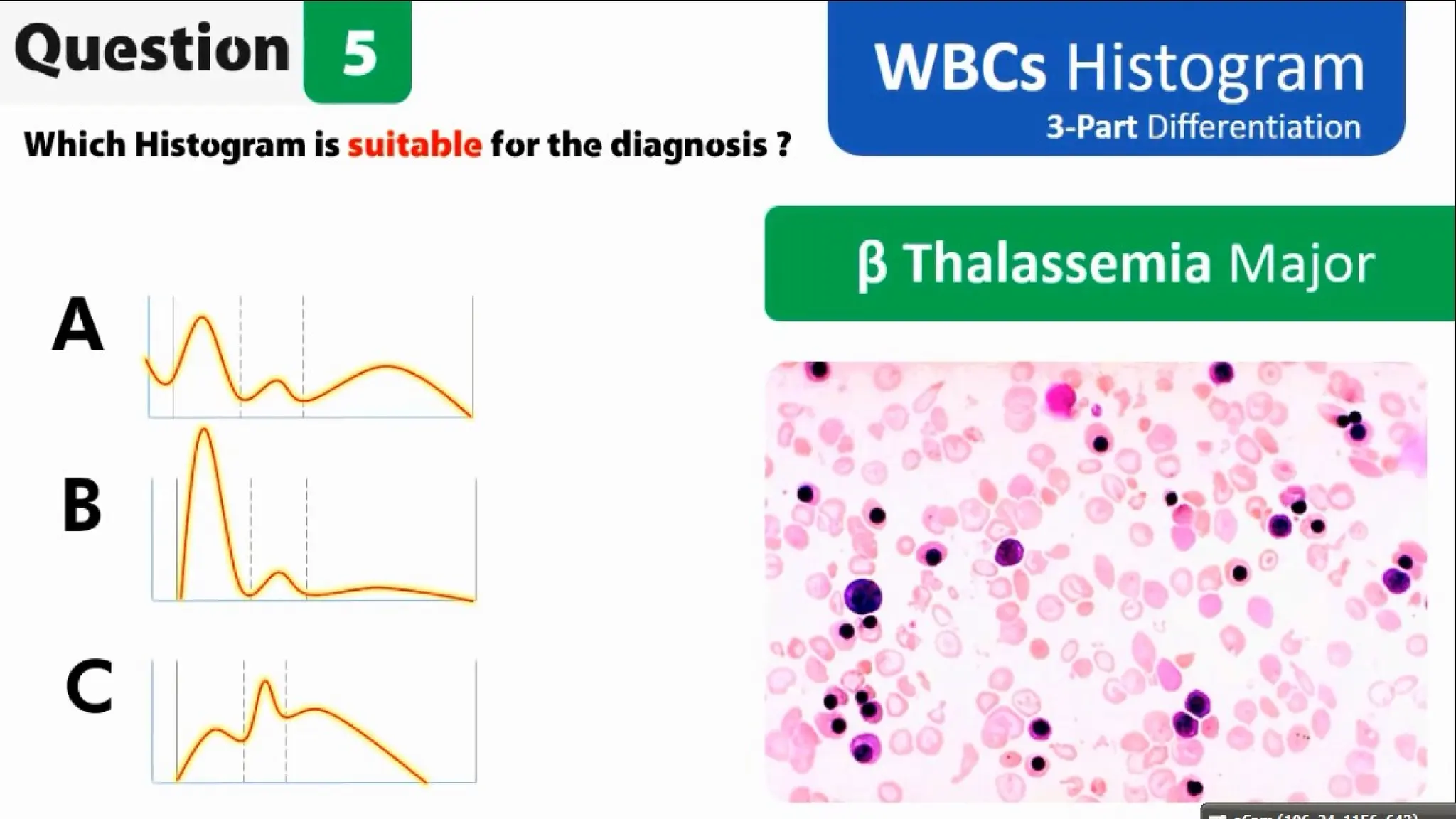 Blood Cell Histograms modified hematology.pptx