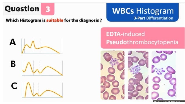 Blood Cell Histograms modified hematology.pptx