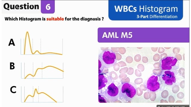 Blood Cell Histograms modified hematology.pptx