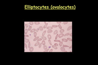 Blood cell morphology.ppt