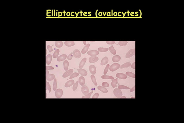 Blood cell morphology.ppt | Blood Disorders | Diseases and Conditions