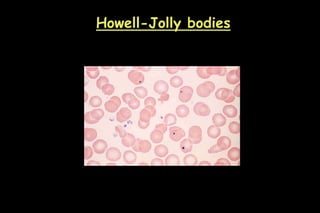 Blood cell morphology.ppt