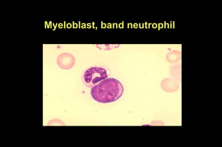 Blood cell morphology.ppt