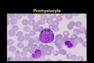 Blood cell morphology.ppt