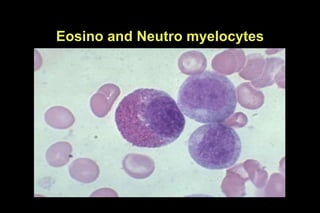 Blood cell morphology.ppt