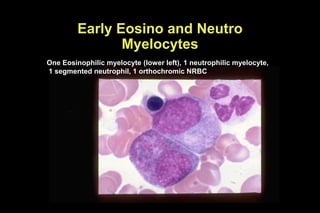 Blood cell morphology.ppt