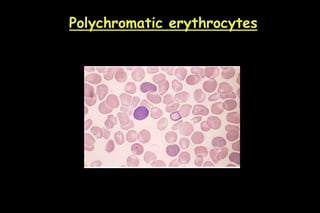 Polychromatic Erythrocyte