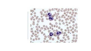 All blood cells(RBC WBC) types......pptx