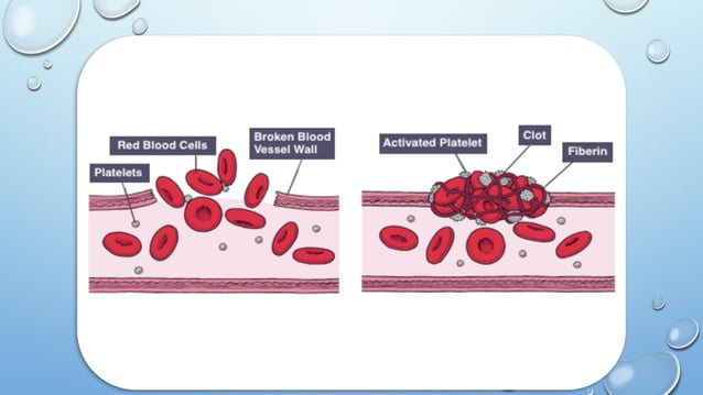 blood clotting. factors, mechanism and body response | PPTX