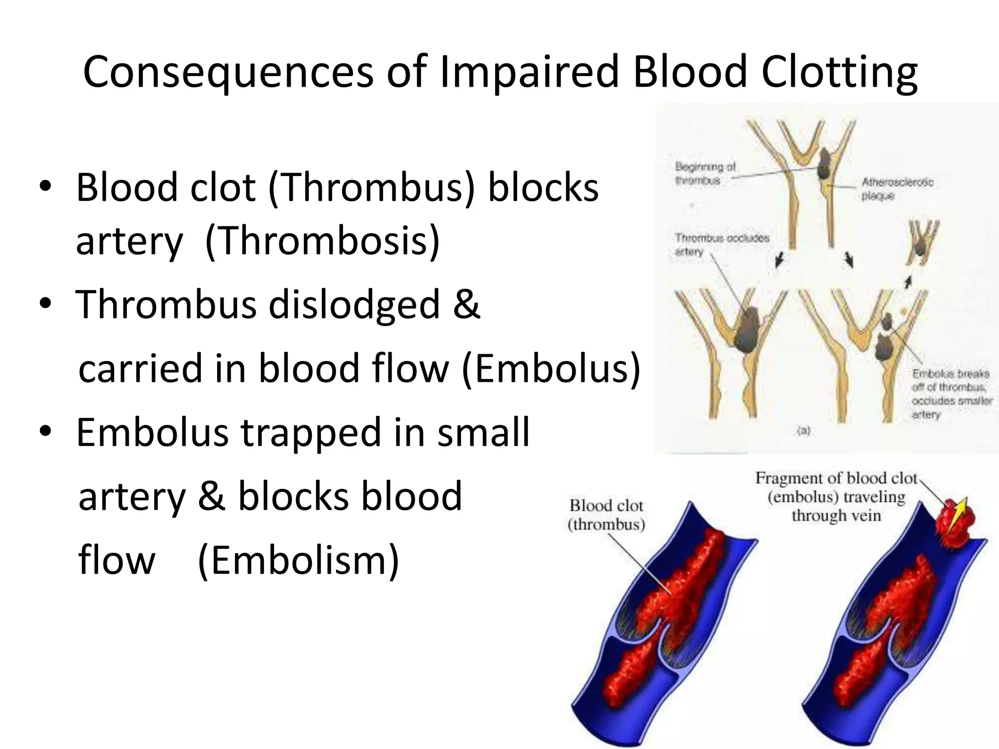Blood clotting | PPTX