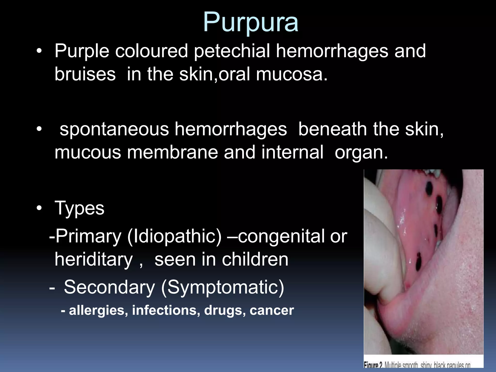 Bloodcoagulation AND USE IN DENTAL MANAGEMENT | PPTX