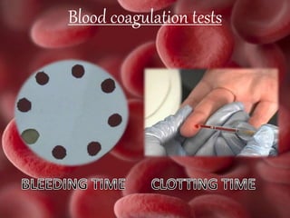 Blood coagulation | PPT