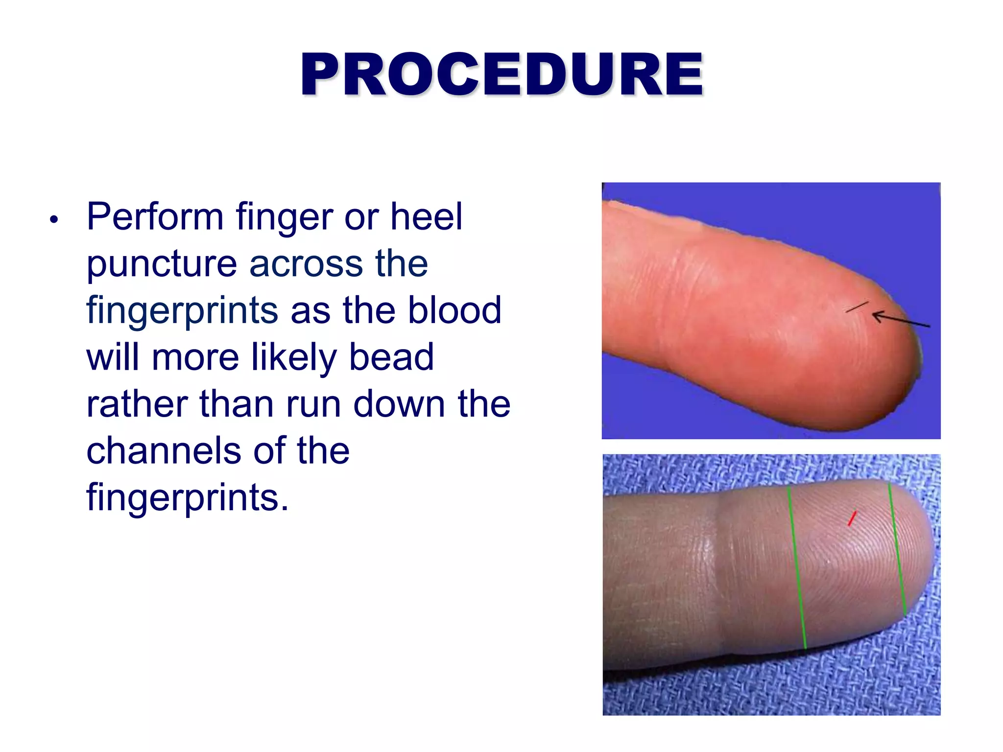 BLOOD COLLECTION.ppt