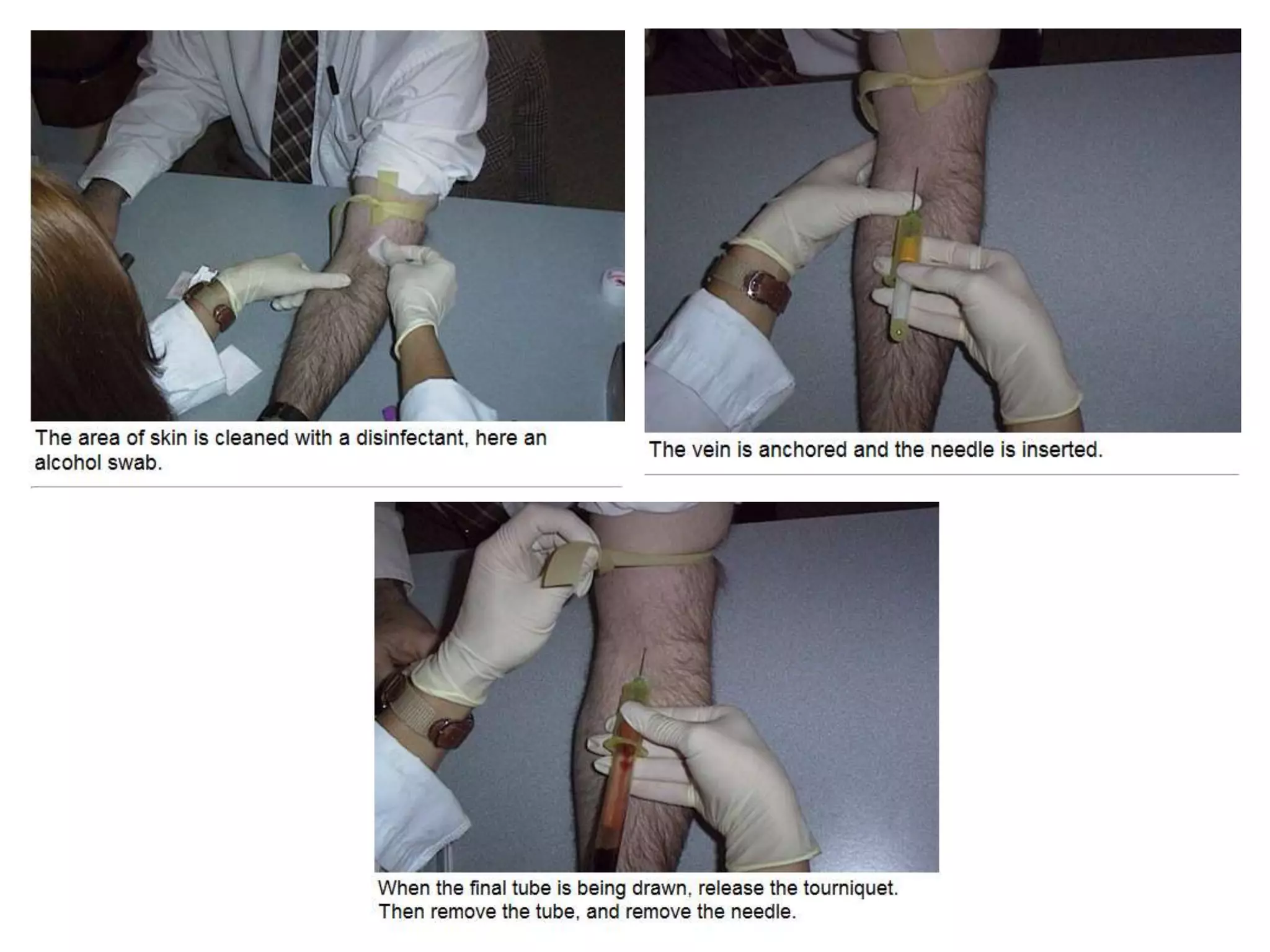 BLOOD COLLECTION.ppt
