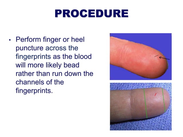 BLOOD COLLECTION.ppt