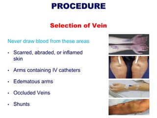 BLOOD COLLECTION.ppt