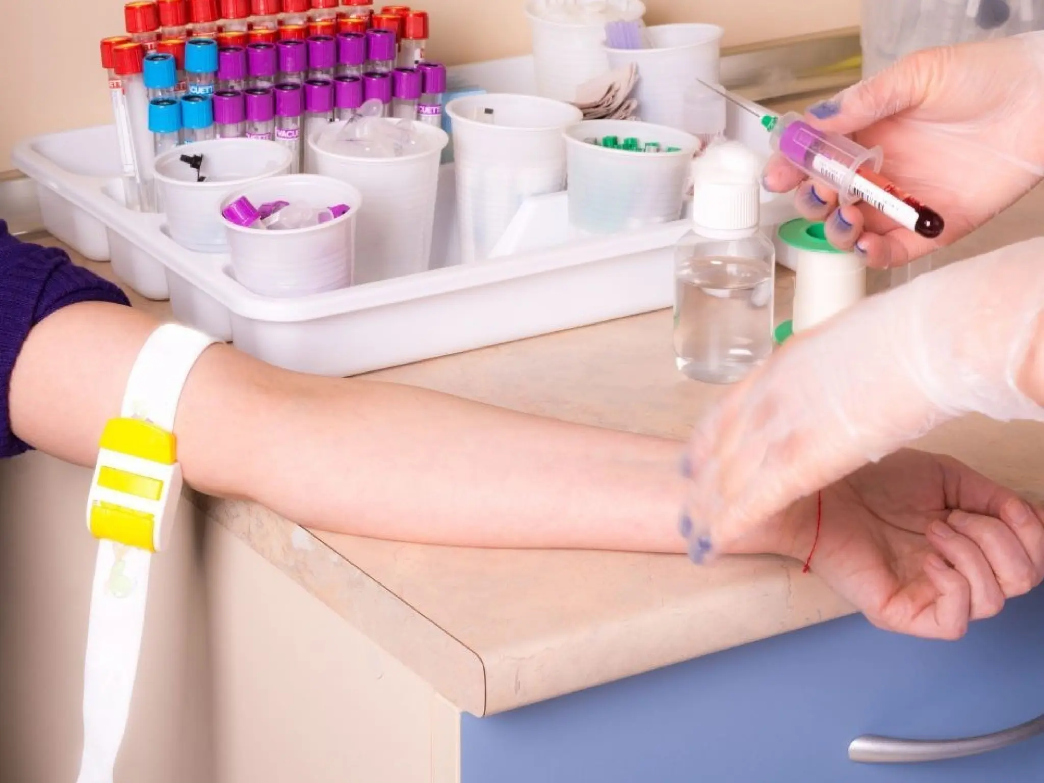 blood collection and method preservation | PPTX