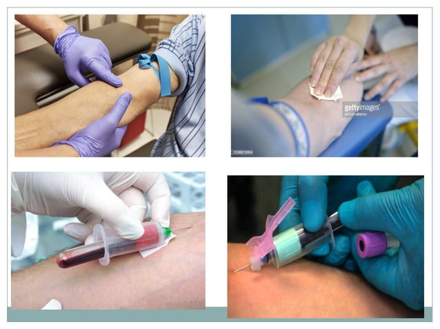 blood collection and method preservation | PPTX