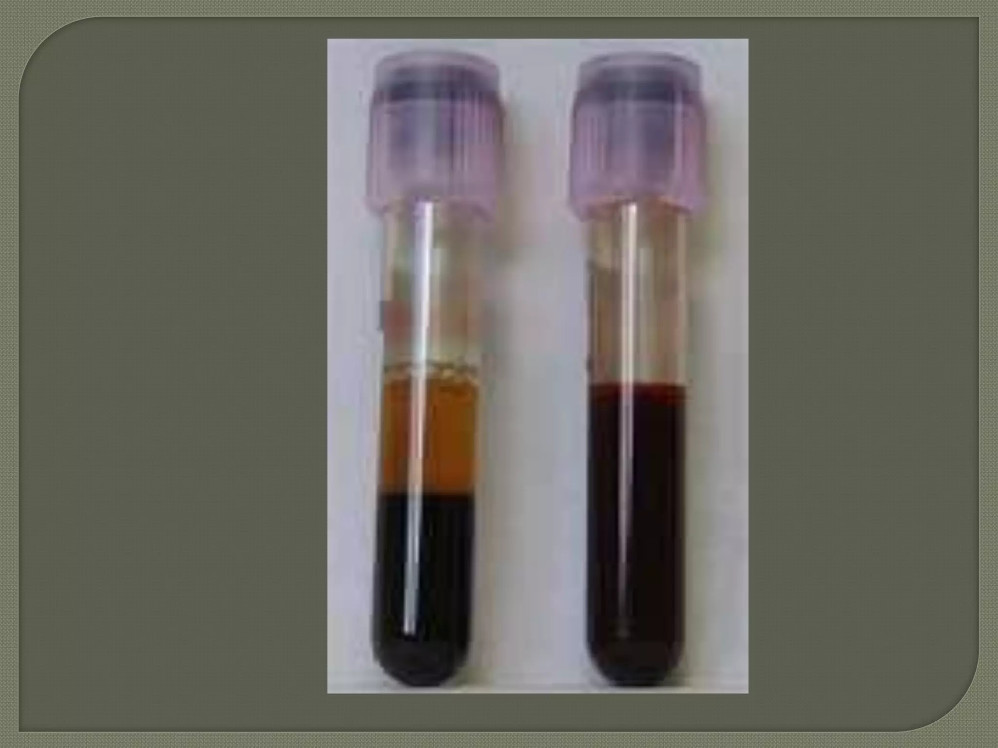 Blood collection, precautions to prevent hemolysis and | PPTX