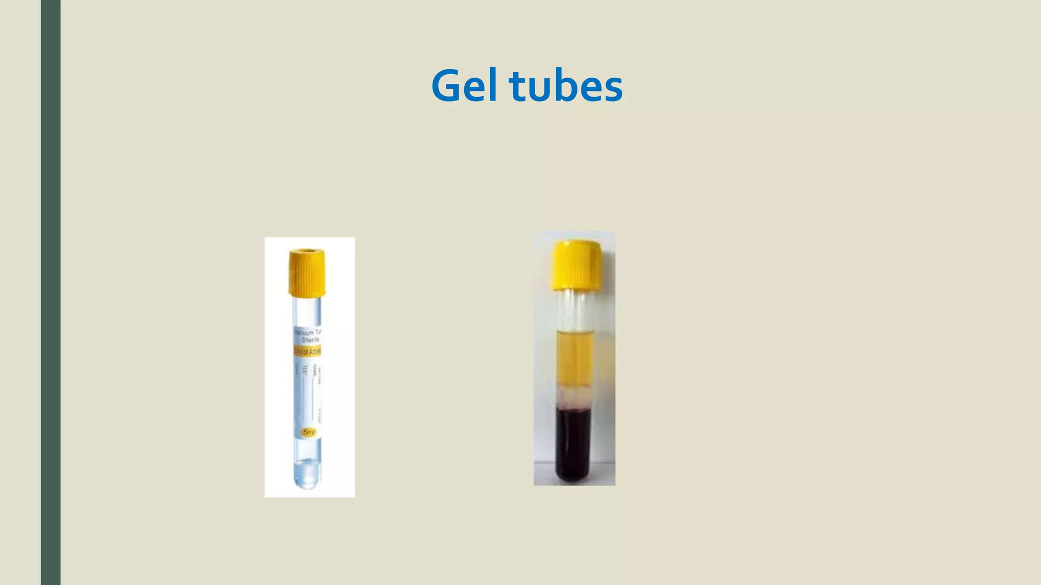 Blood collection tubes - Colour coding of vials, Order of draw | PPTX