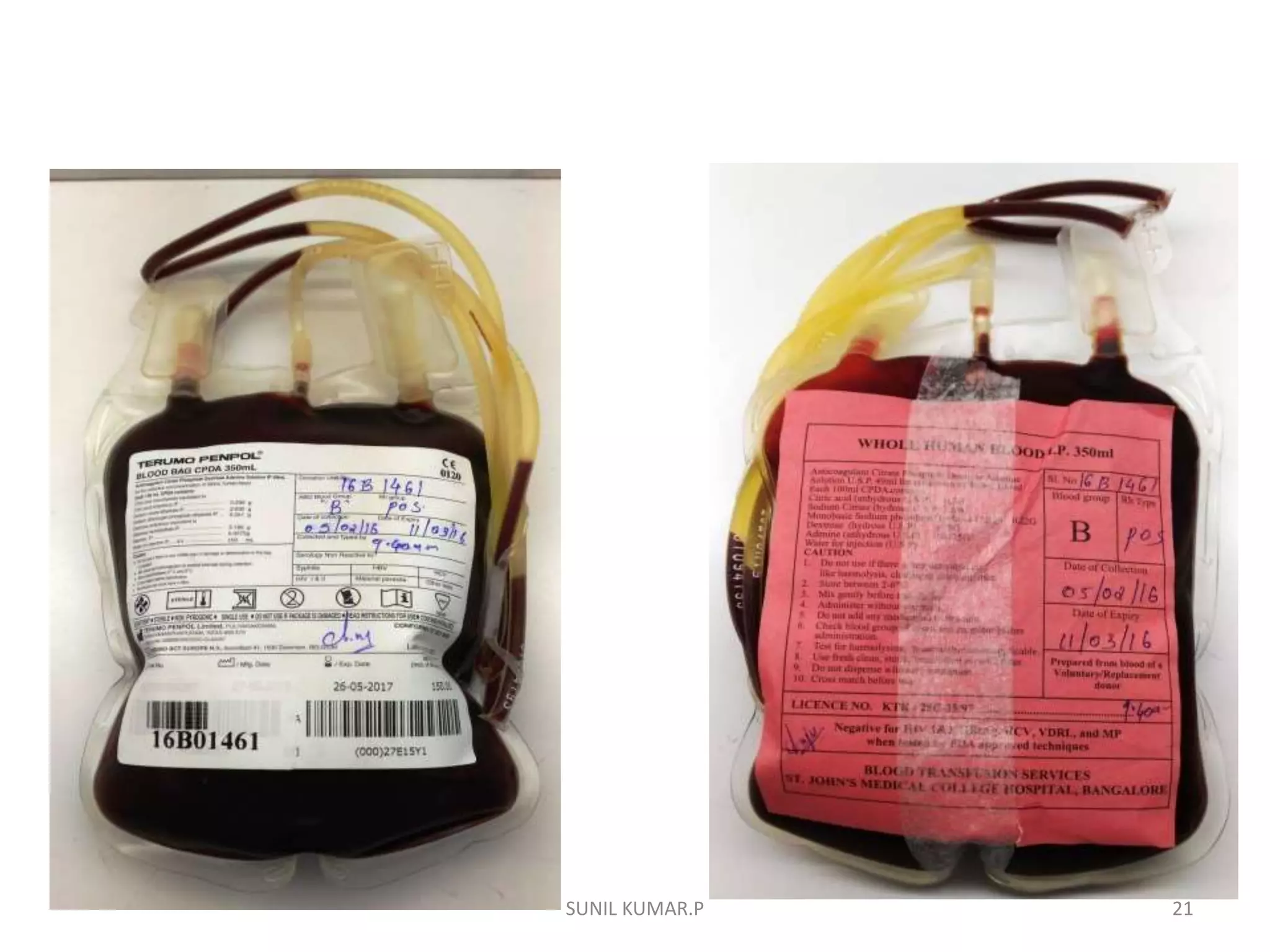 Blood component preparation | PPTX