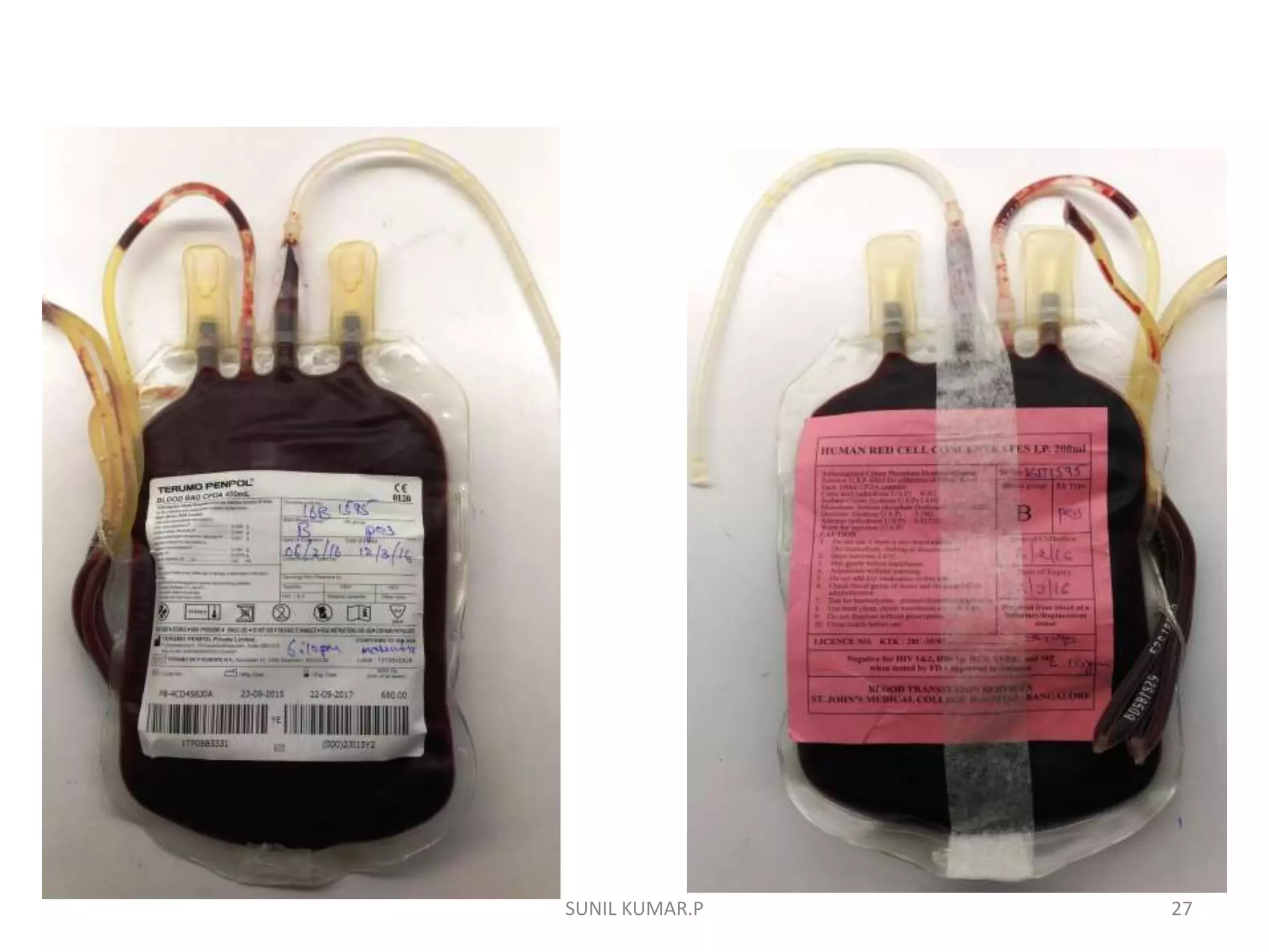 Blood component preparation | PPTX