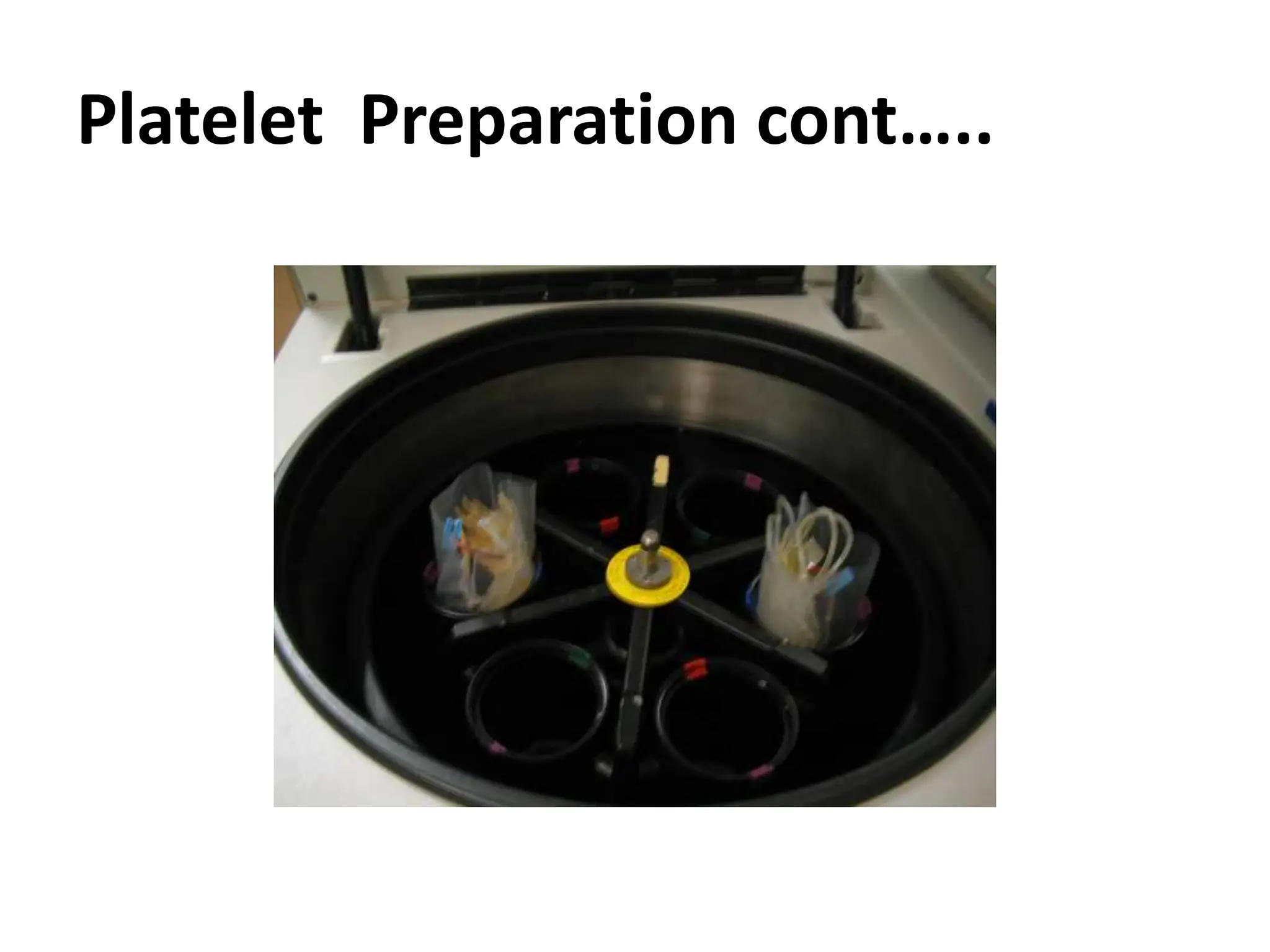 BLOOD TRANSFUSION COMPONENT PREPARATION.ppt
