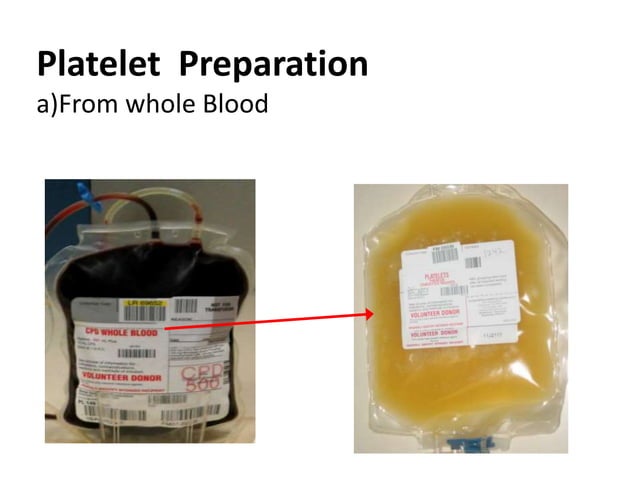 BLOOD TRANSFUSION COMPONENT PREPARATION.ppt | Blood Disorders ...