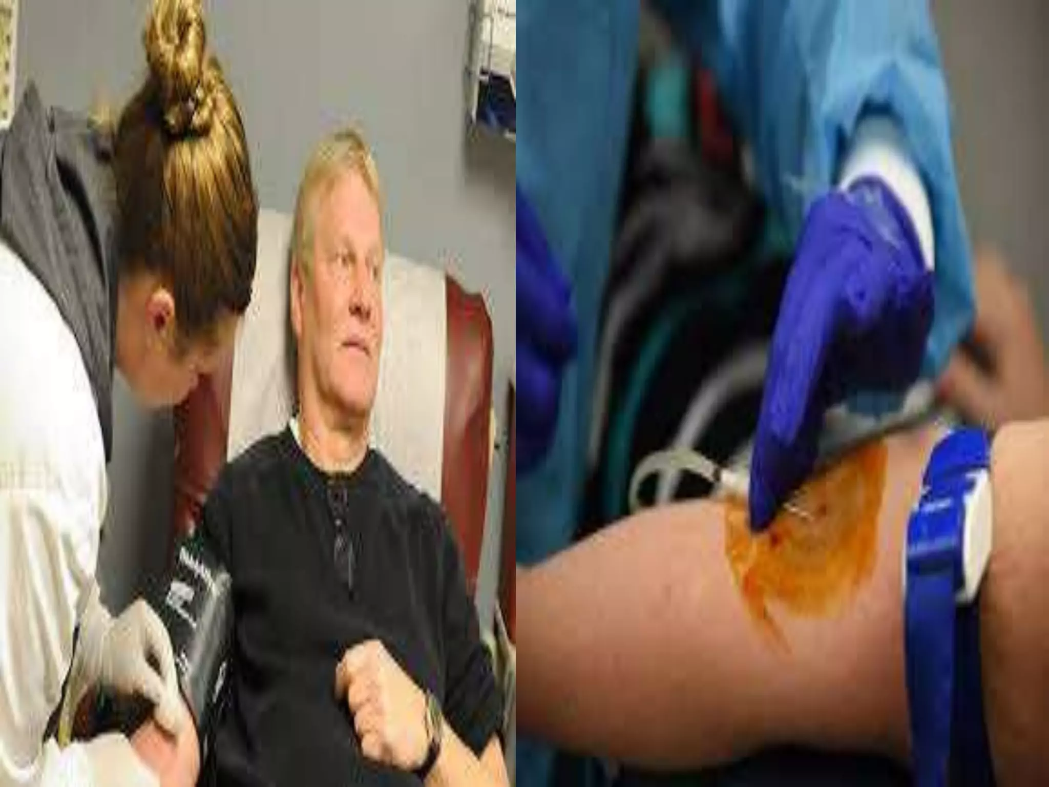 Blood component, sample collection, storage, preservation | PPTX