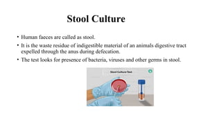 Blood Culture^J Urine Culture^J Stool Culture.ppt