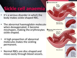 blood diseases.pptx