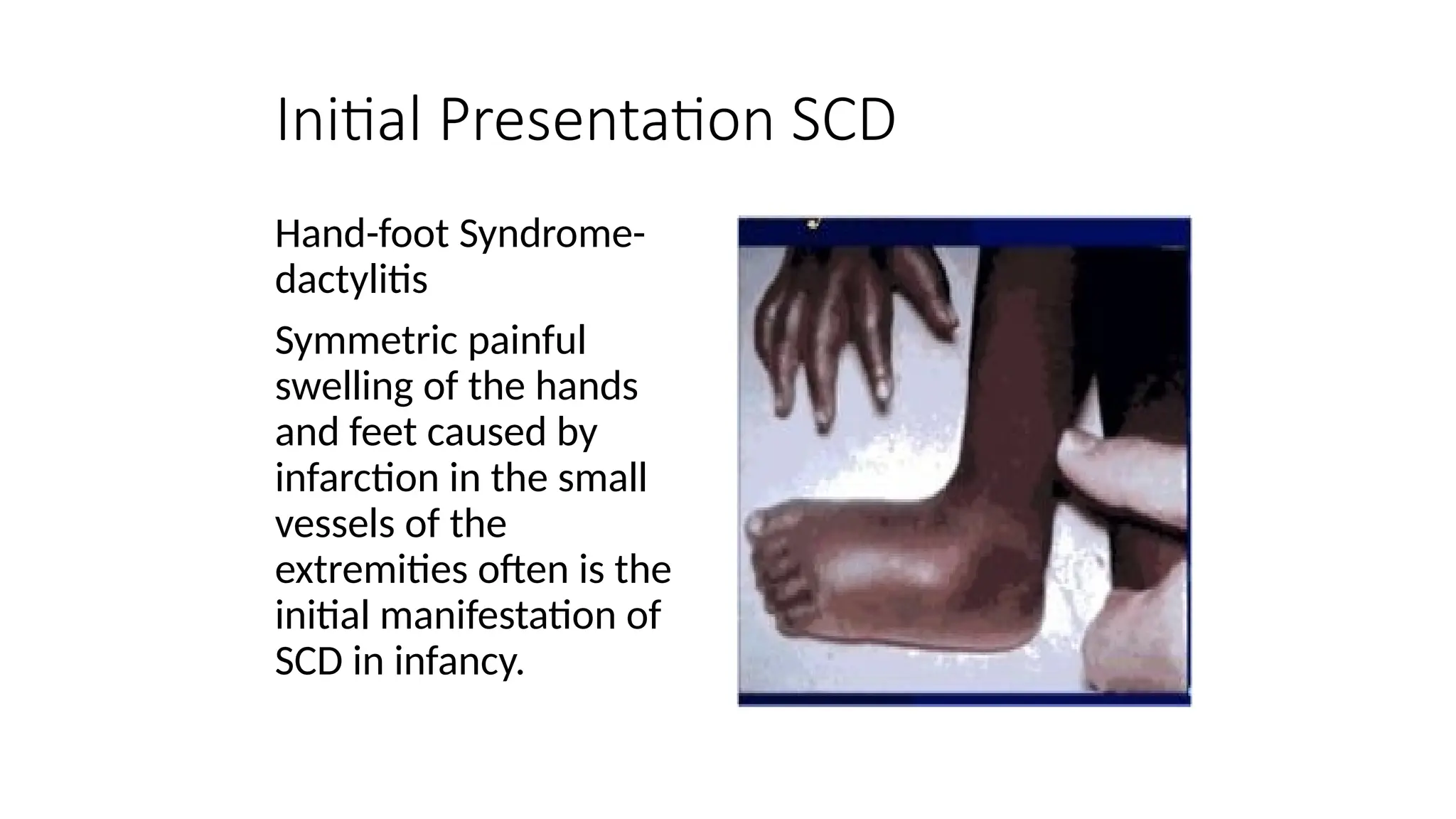 blood Disorders for nurses and midwifery.pptx