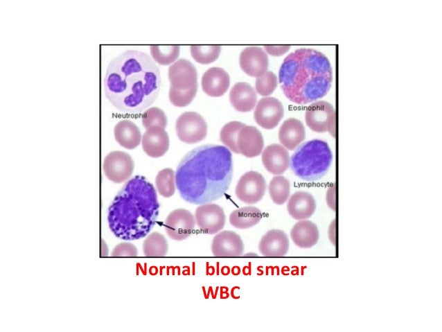 Blood film