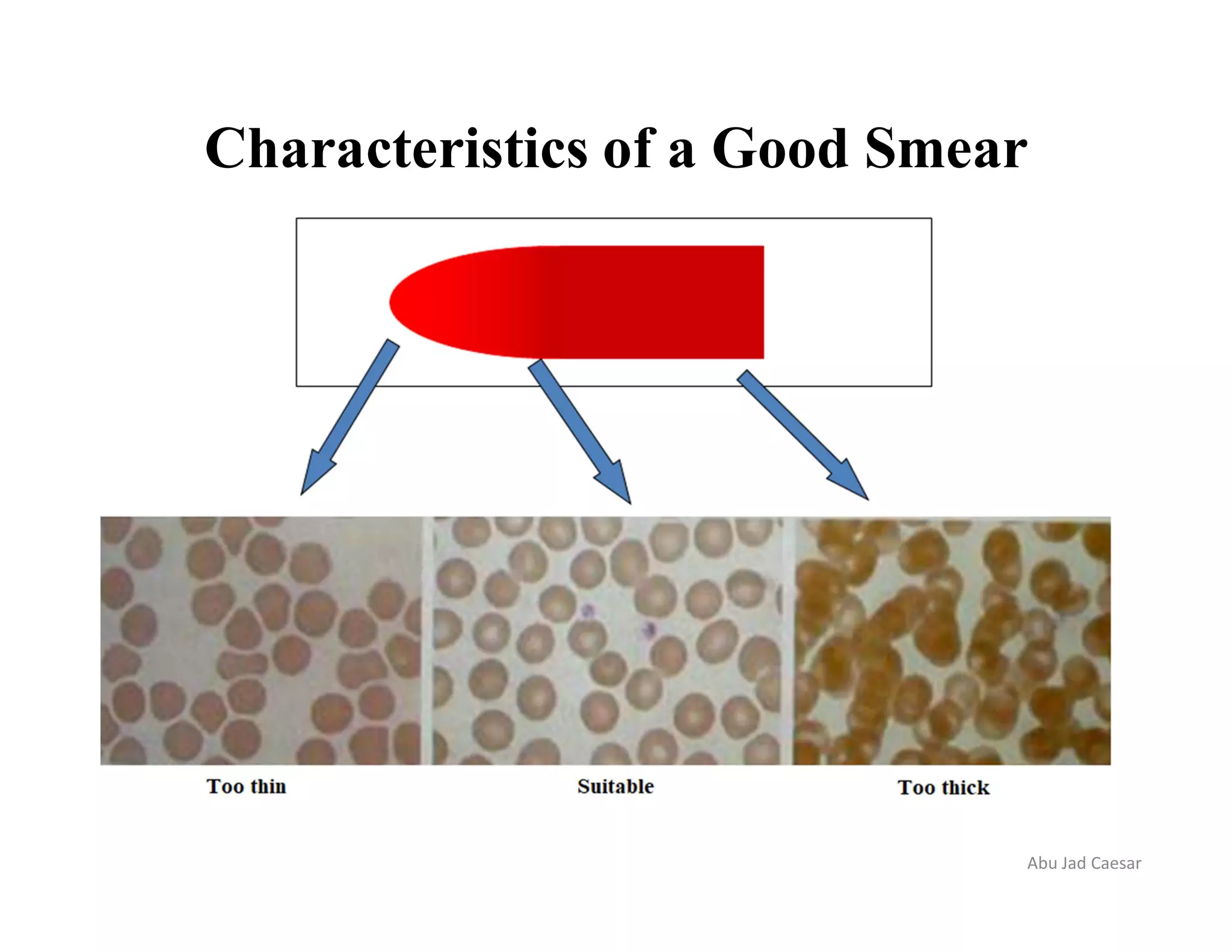 Blood film preparation and reporting | PDF