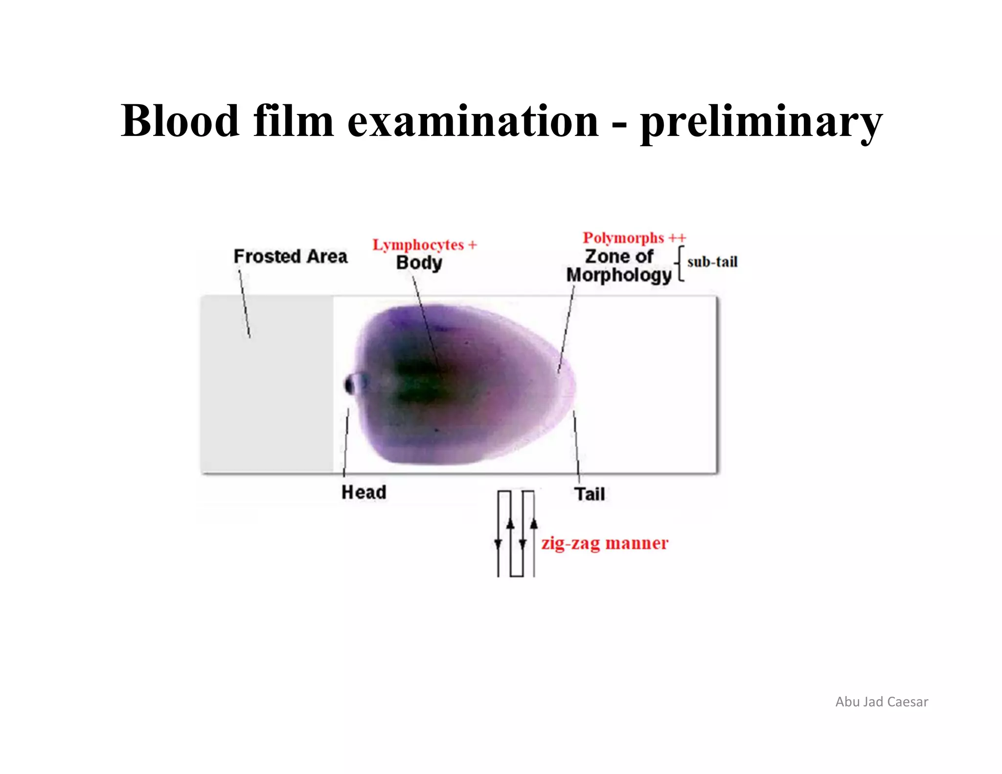 Blood film preparation and reporting | PDF
