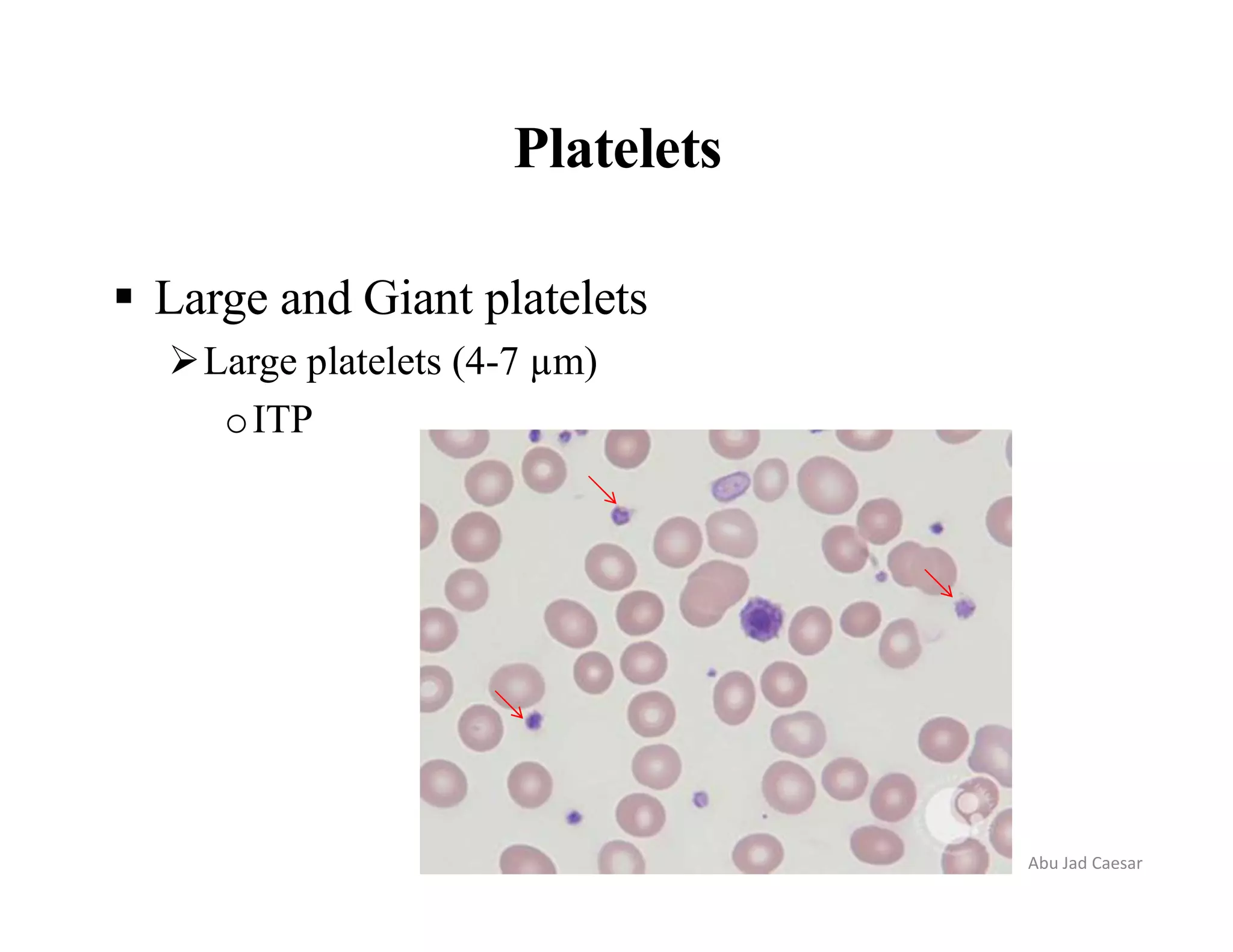 Blood film preparation and reporting | PDF