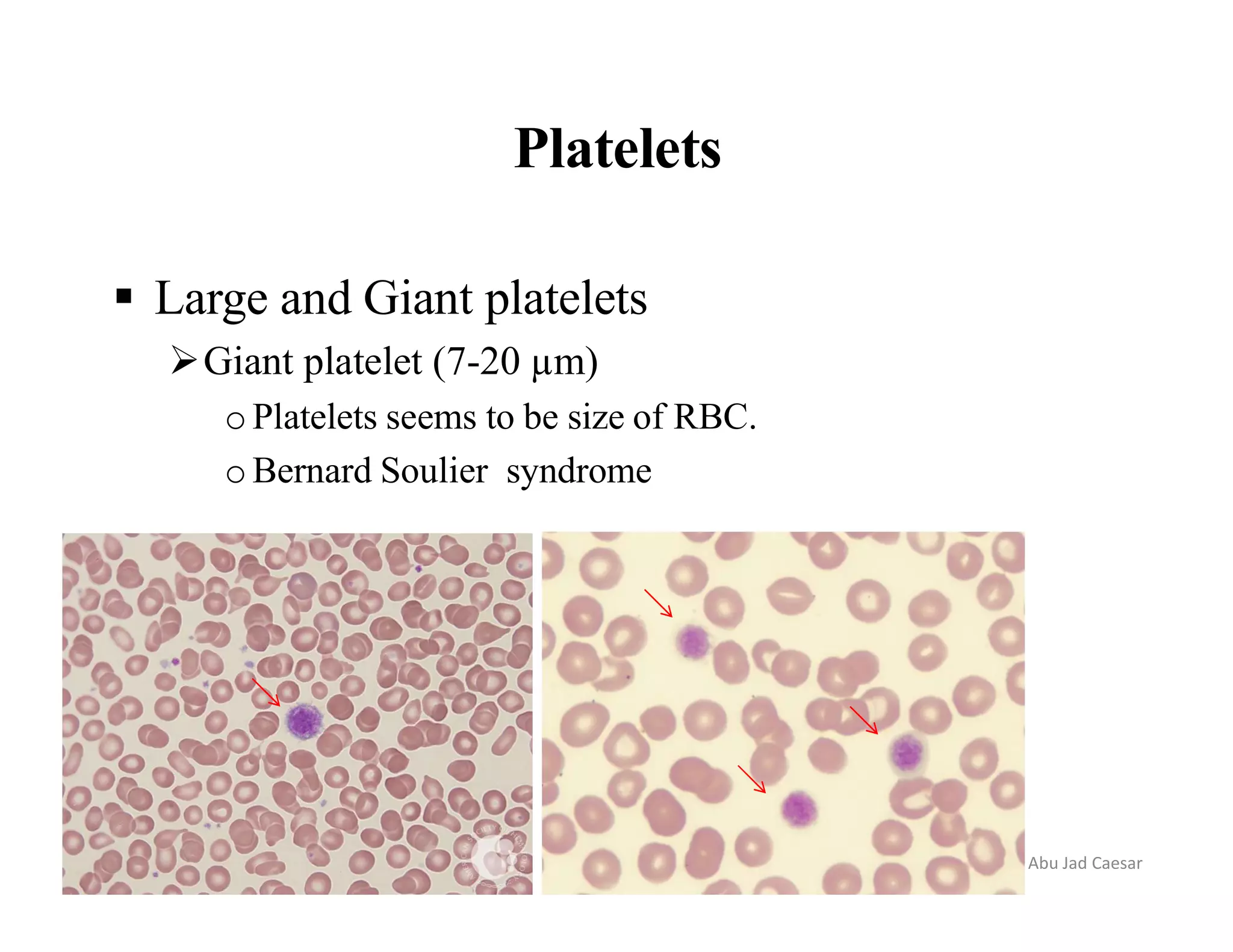 Blood film preparation and reporting | PDF