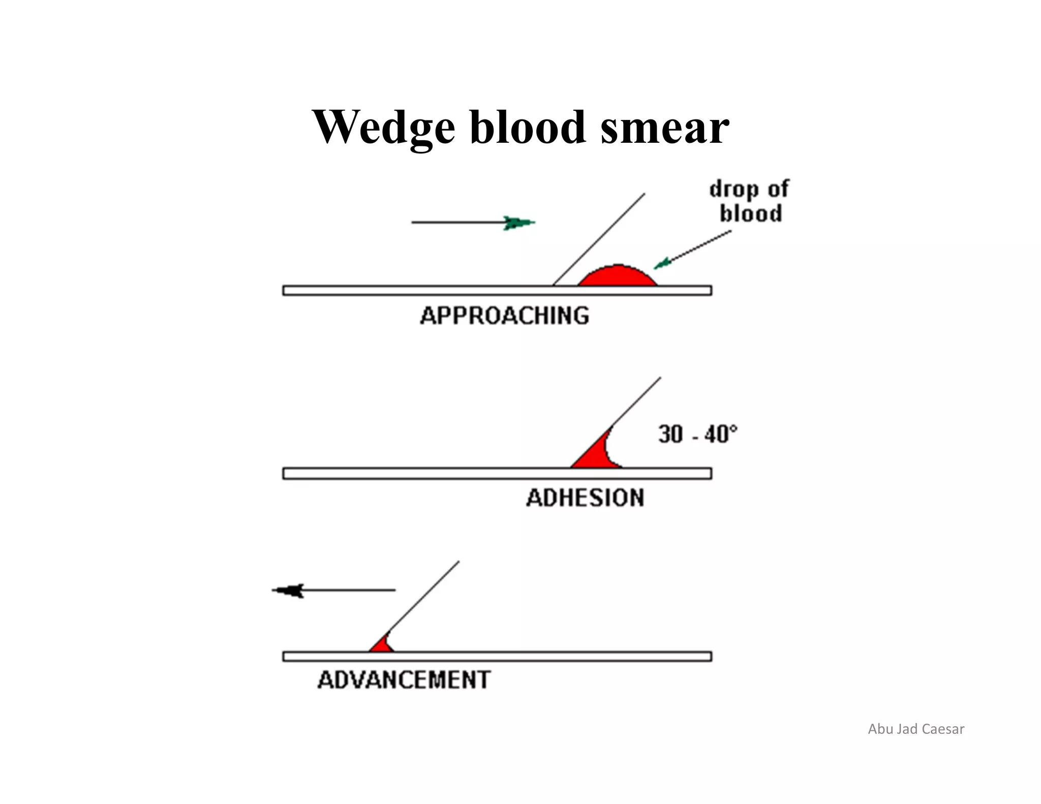 Blood film preparation and reporting | PDF