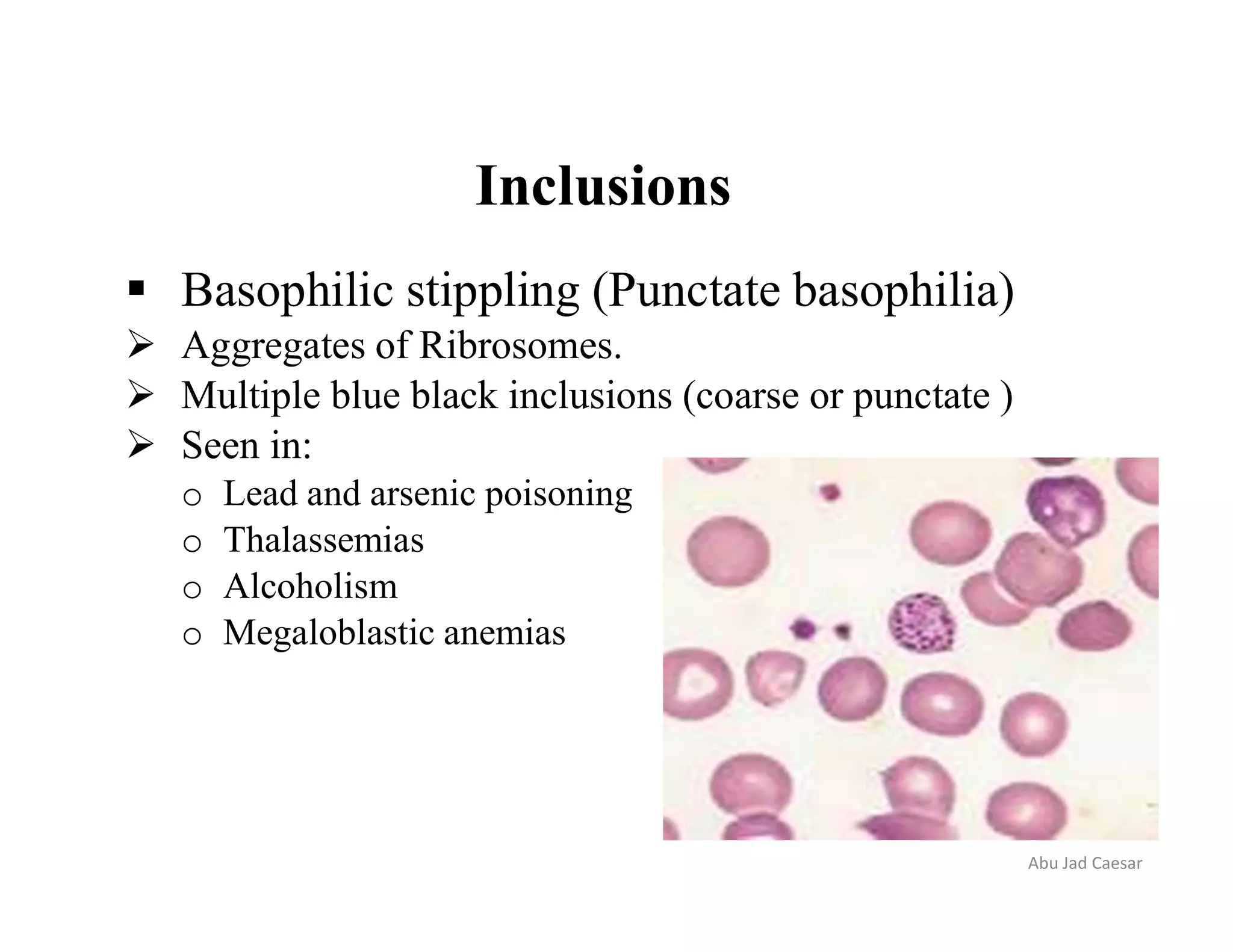 Blood film preparation and reporting | PDF