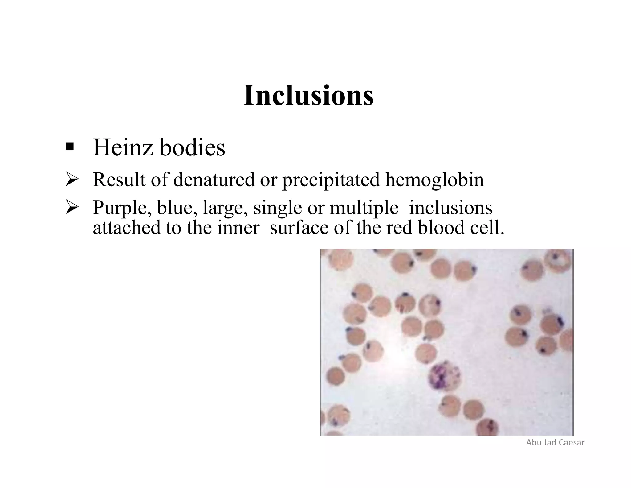 Blood film preparation and reporting | PDF