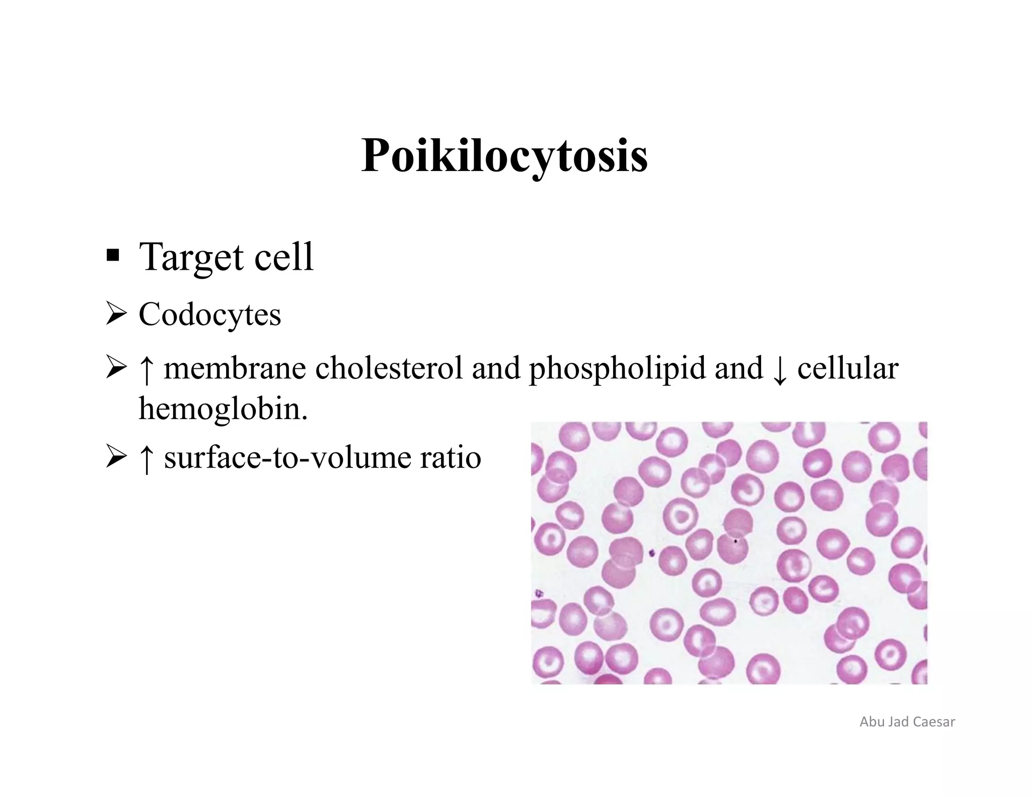 Blood film preparation and reporting | PDF