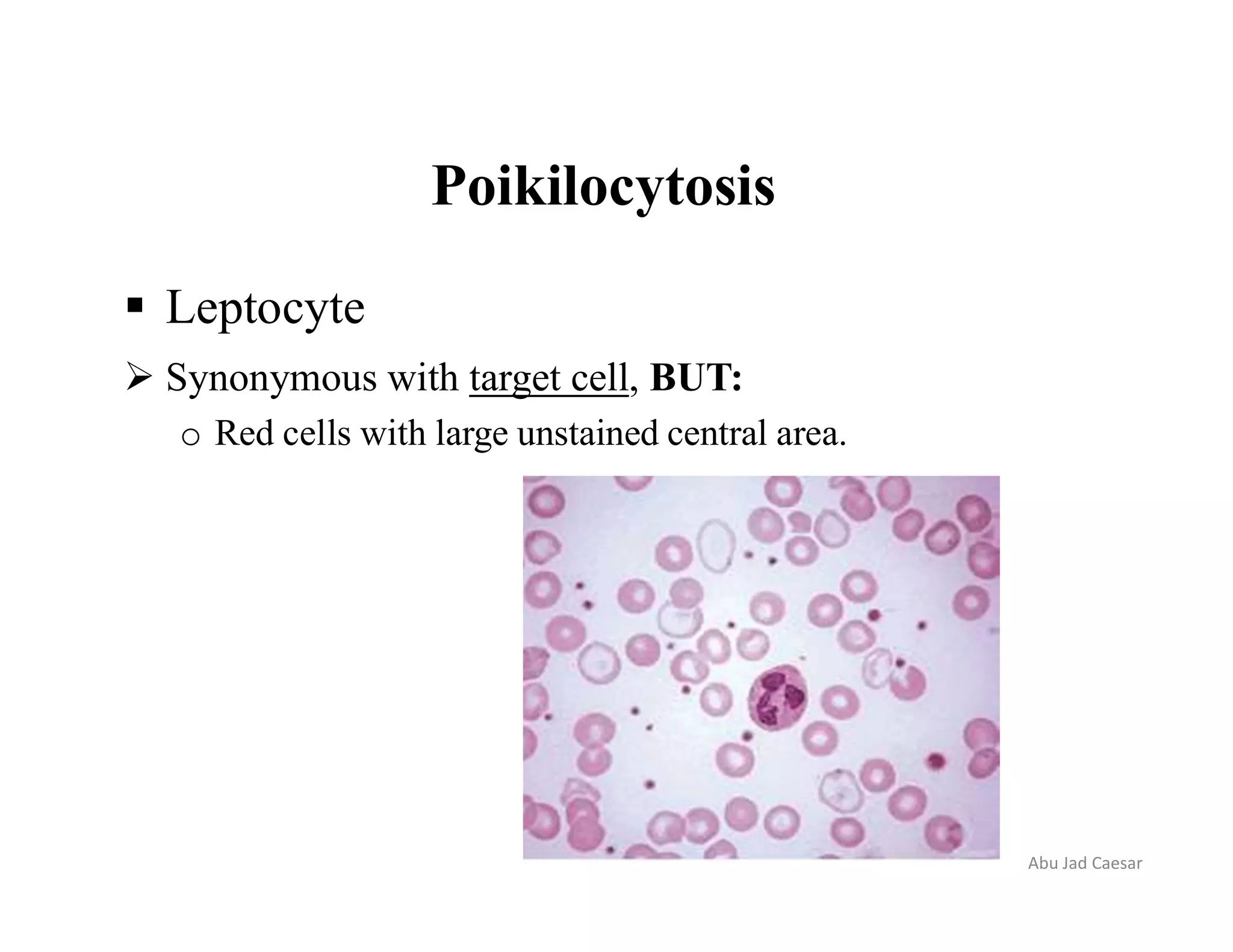 Blood film preparation and reporting | PDF